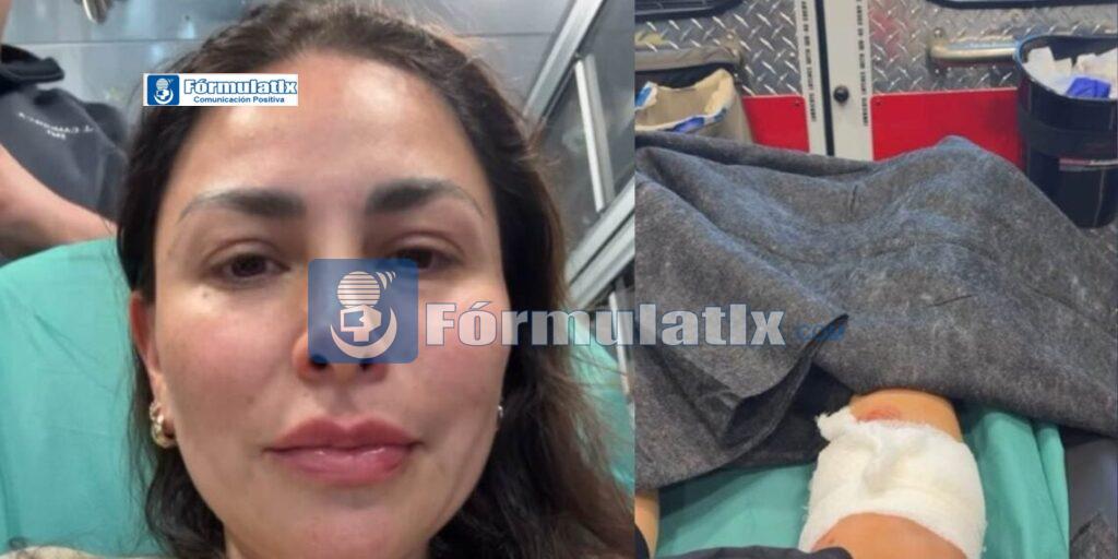 La conductora Gaby Ramírez, es mordida por un perro: ¿Cuál es su estado ...